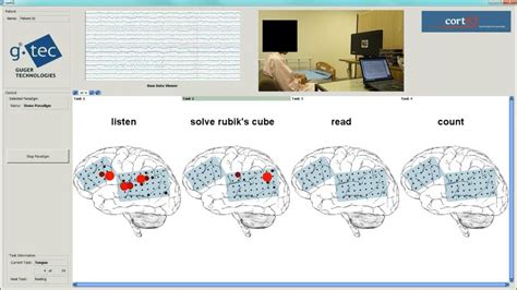 Cortiq Real Time Brain Mapping Using Electrocorticogram Ecog Gtec