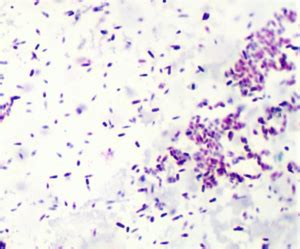 5 Ways To Correct Precipitate In Hematology Stains Ethos Biosciences