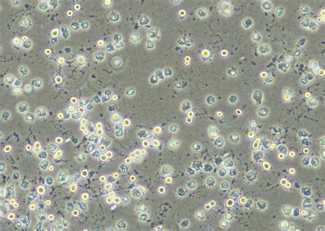 What Do Dead Cells Look Like Under A Microscope At Frances Morrow Blog