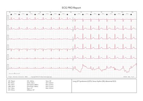 Ecg Pro Report 51063 Pdf