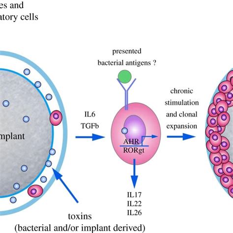 The Pathogenesis Of Bia Alcl Is Probably Multifactorial But Probably