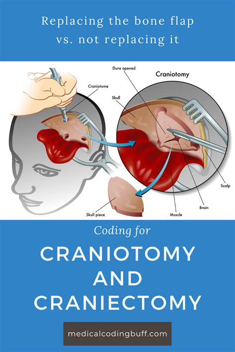 The Key To Craniotomy And Craniectomy Coding Cpt Artofit