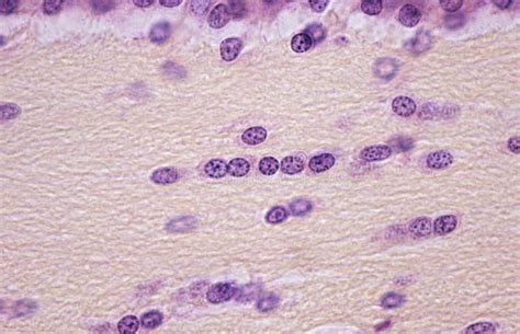 White Matter Oligodendroglia Stock Image Image Of Tissue Microscope