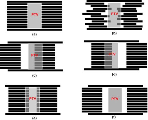 Three Types Of Mlc Position Errors Introduced To Each Sbrt Plans A Download Scientific