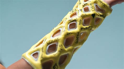 Cast21 Is The Arm Cast Of The Future Designwanted