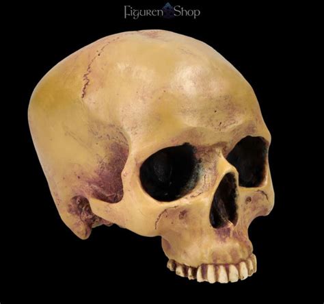 Anatomical Skull Jawless And Striking Detail