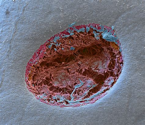 Bacteria In Tooth Cavity Sem Stock Image C0578419 Science Photo