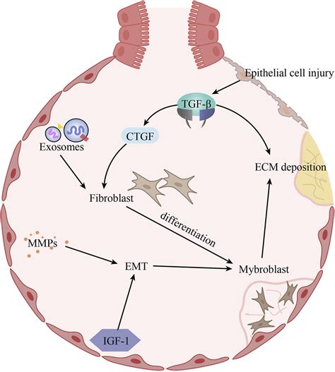 Frontiers Progress In Understanding And Treating Idiopathic Pulmonary