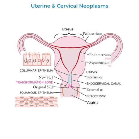 External Os Of Cervix Sagittal View Of Anatomic Landmarks For
