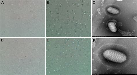 Infected Oftu Cells And Electron Microscopic Examinations Of The Orf