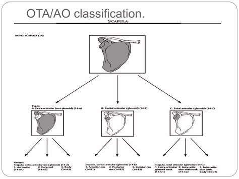 Scapula Fracture Diagnosis And Management Pptx