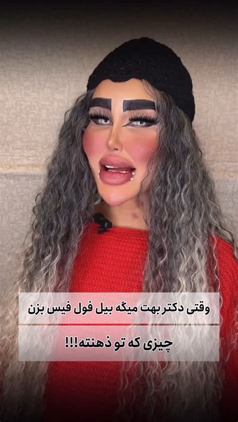 لیزر بوتاکس فیلر جراحی زیبایی‎ ‎ ولاگ پـــی ار پـــی پرسنل عزیزمون😍 پی ار پی انقدر تاثیر