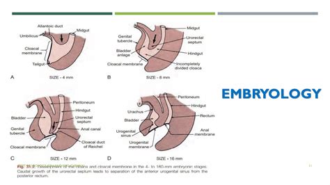 Pediatric Urology Bladder Extrophy And Epispadias Complex Pdf