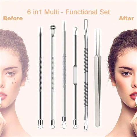 1set Pimple Popper Tool Kit Blackhead Remover Acne Needle Tools Set