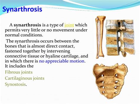 Ppt Arthrology And Joints Of Bones Of Trunk Powerpoint Presentation
