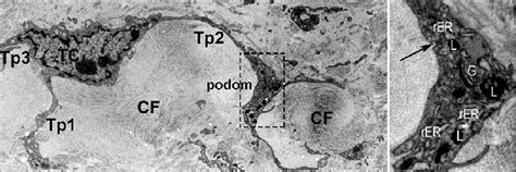 Ultrastructure Of Podom Of Telopode Tp In Adventitia Of Mouse Aortic