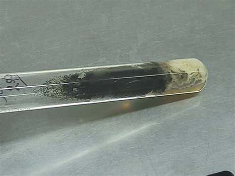 Cavitary Lesion Archives Medical Notes