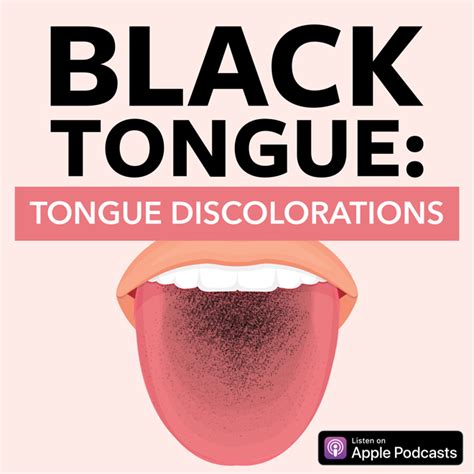 Black Tongue Tongue Discolorations