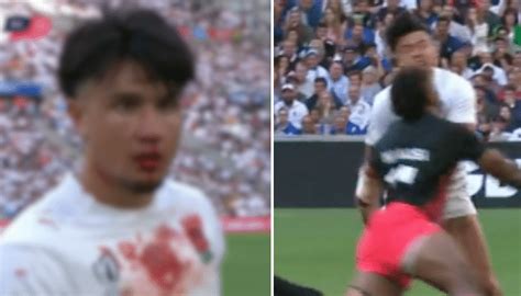 That Was Brutal Marcus Smith Left A Bloody Mess After Brutal Hit