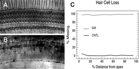 Cochlear Hair Cell Loss A Representative Surface Preparation Of