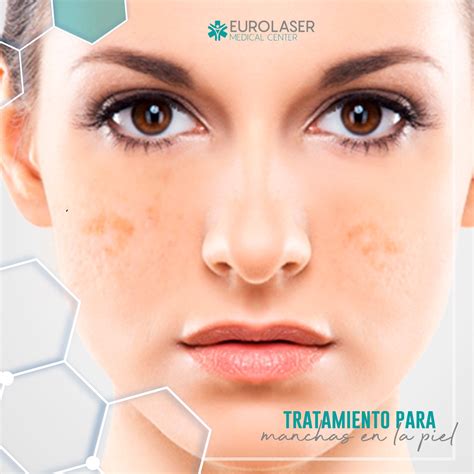 Euro Eurolaser Clinica De Medicina Estética En Cd Juárez