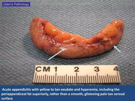 Appendix Gross Pptx