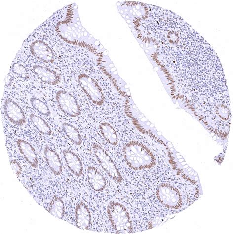 Normal Tissue Gallery Tle1 Ms Validated Antibodies