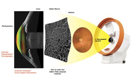 Meet Eyefinity Encompass Eyefinity Unveils All In One Integrated Practice Management And Ehr