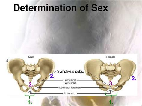 Ppt Forensic Anthropology Studying Bones Powerpoint Presentation