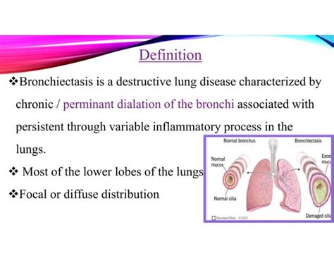 Bronchiectasis Ppt Pdf