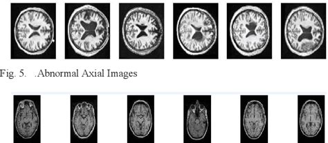 Figure 1 From Brain Stroke Detection Using Convolutional Neural Network And Deep Learning Models