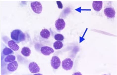 What Are The Cells That Are Indicated By The Arrows In The Joint Fluid