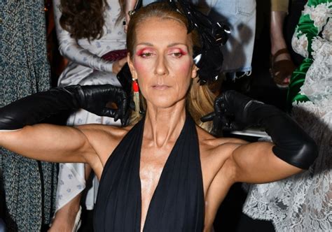 Celine Dion Cierpi Na Zespół Sztywnego Człowieka Czy Kiedykolwiek Wróci Do śpiewania Pomponik Pl