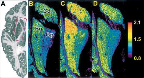 Figure 2 From Autoradiographic Mapping Of Dopamine D 2 ⁄d 3 Receptor Stimulated 35 Sgtpcs