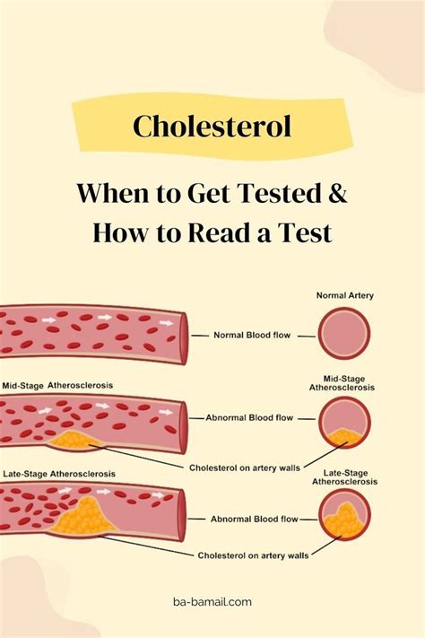 Cholesterol When To Get Tested And How To Read A Test High