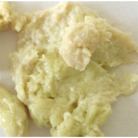 Panel With The Eight Stool Photographs Shown To Participants Download Scientific Diagram