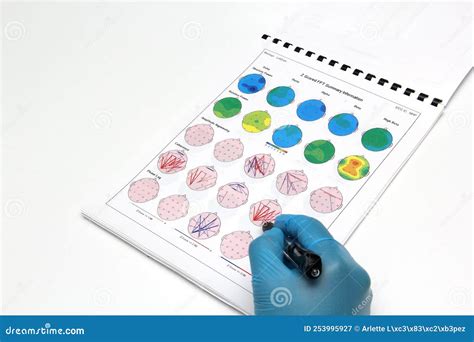 Brain Mapping Done By A Neurologist Doctor With Neuroscience Technique