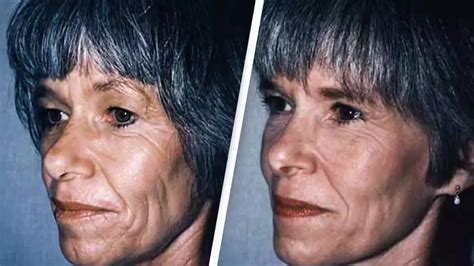 Identical Twins Show Astonishing Differences After One Had A Lot More Sun Exposure Over Their