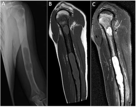 Beyond The Signal Imaging Insights And Diagnostic Relevance Of Bone