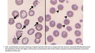 Erythrocyte Morphology And Inclusions 2 2 Pptx