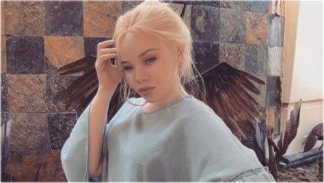 I Was Never Shameful About My Albinism Michelle Mosalakae On Her Success News24