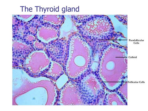 Ppt Congenital Hypothyroidism Powerpoint Presentation Free Download
