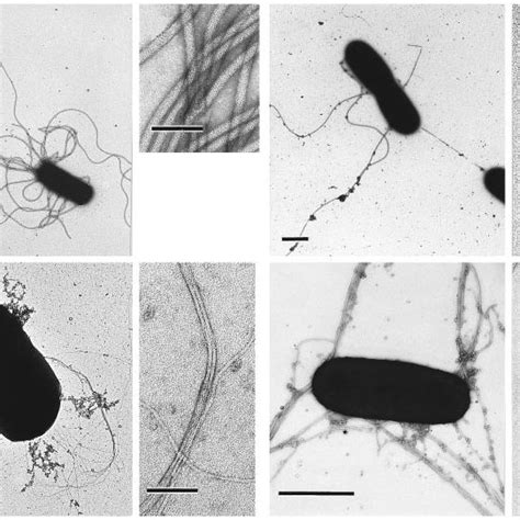 Phylogenetic Relatedness Between Psychrophilic Bacteria From Surface