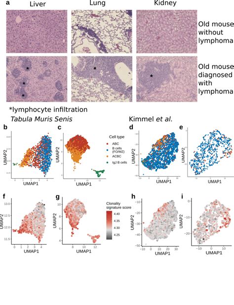 Supplementary Figure 4 Age Associated And Clonal Age Associated B