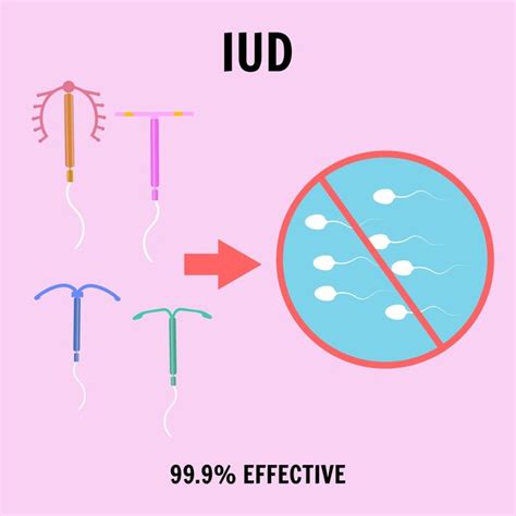 Premium Vector Intrauterine Device Contraception In Vector