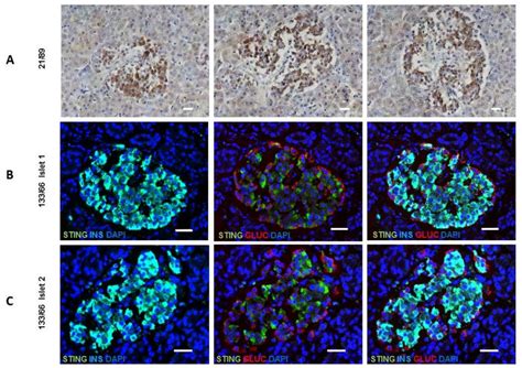 Sting Expression Is Present In The Islets Of Human Individuals In Both
