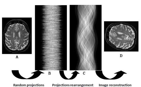 Estimating View Parameters From Random Projections For Tomography Using