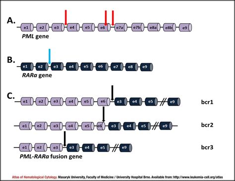 Acute Promyelocytic Leukaemia With Pml Rara Cell Atlas Of