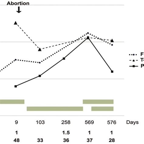 A And B Dwis Show Acute Stroke On The Left Hemisphere Dwi Aspects Is