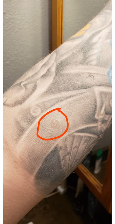 Does Anyone Know What This Is On My Healed Tattoo Rtattooadvice